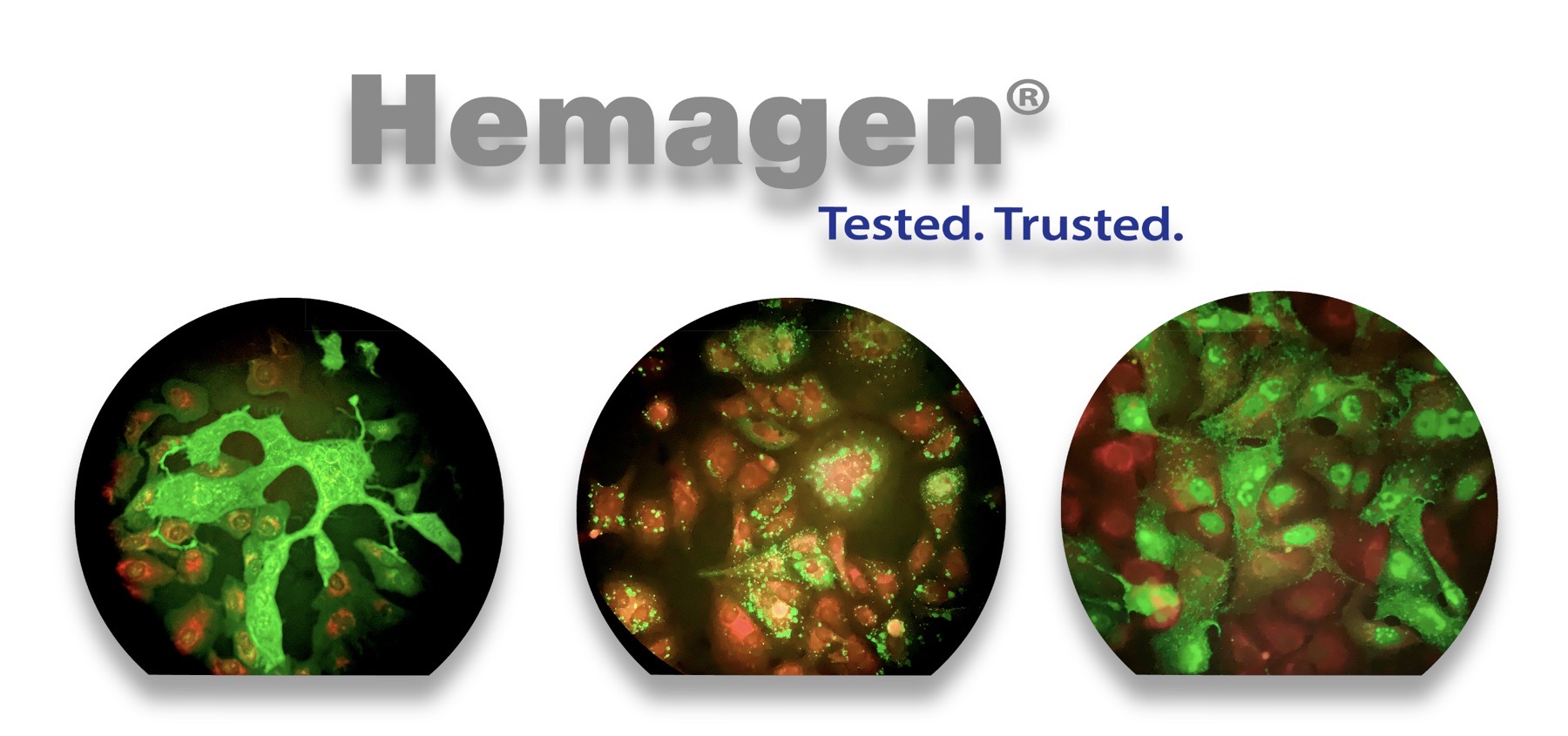 Infectious – Global Focus Marketing & Distribution